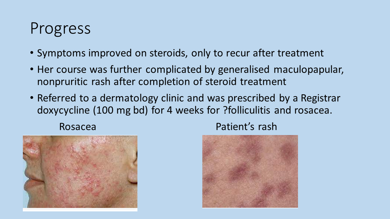 An otosyphilis case report presentation by Dr Aleksandra Sasha Jaksic